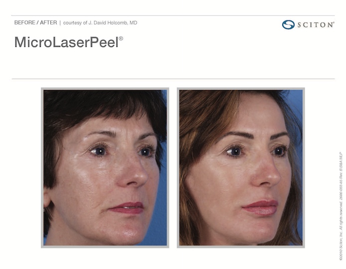 Contour TRL™ | Paul Pin, MD